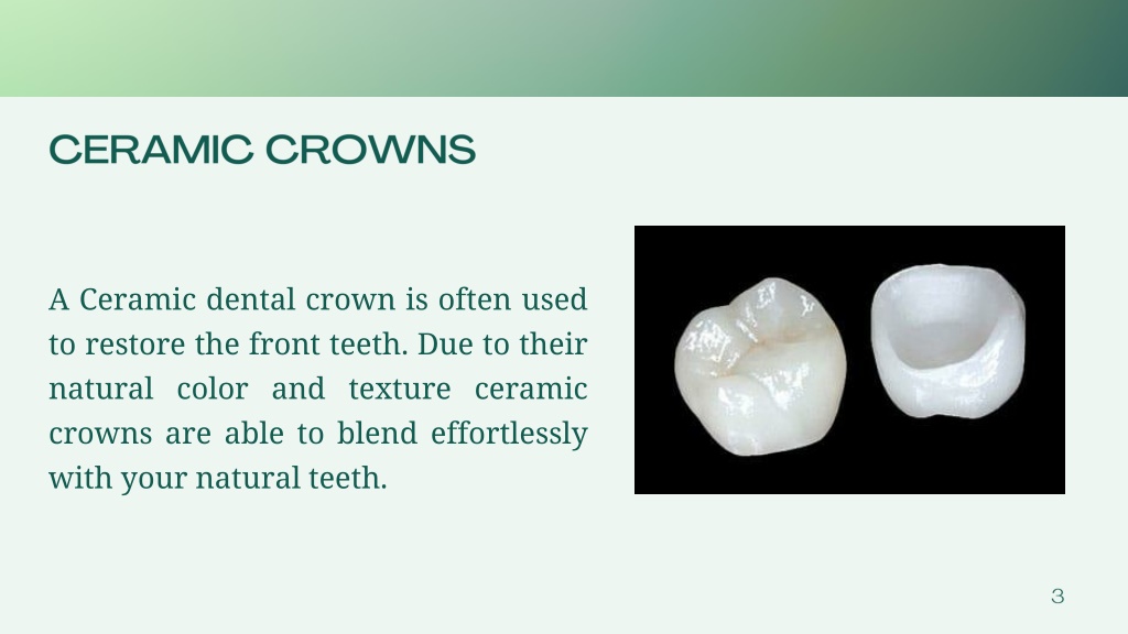 PPT - Dental Crowns : All you need to know PowerPoint Presentation ...