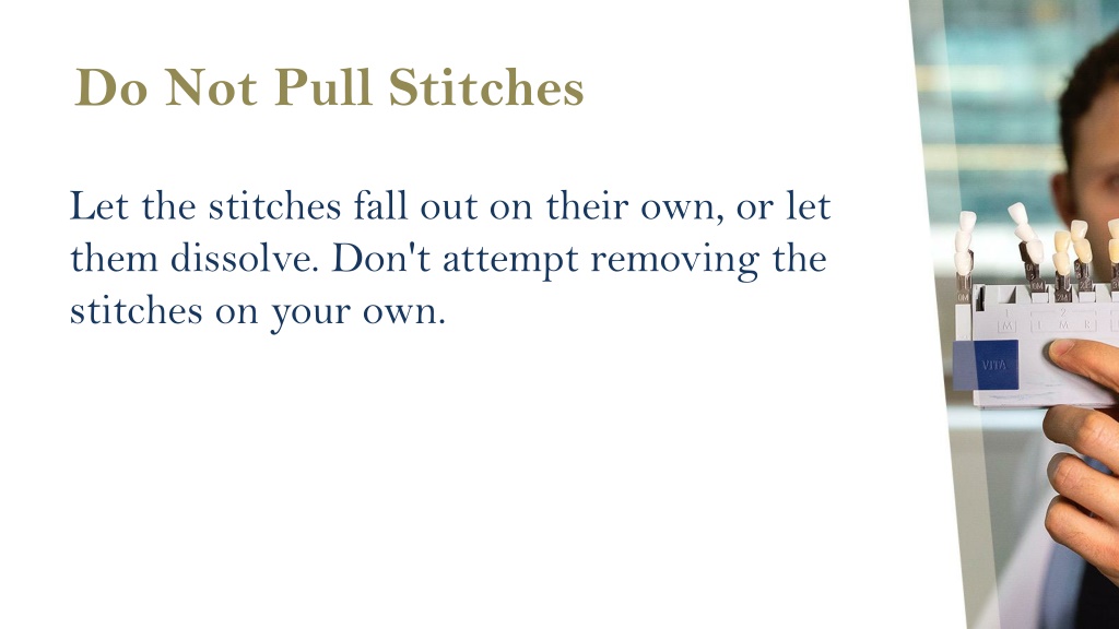 PPT - Guides For Your New Dental Implant PowerPoint Presentation, free ...