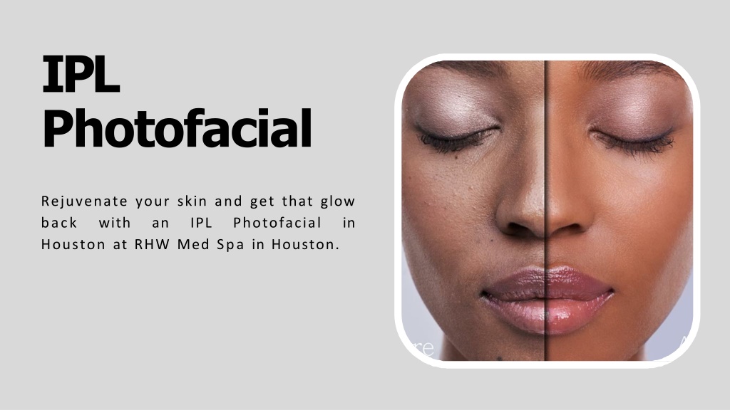 PPT - Best Aesthetic Treatments PowerPoint Presentation, free download ...