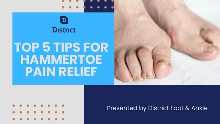 PPT - Top 5 Tips for Hammertoe Pain Relief PowerPoint Presentation ...