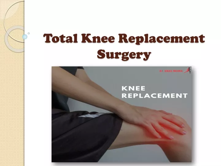 PPT - Total Knee Replacement Surgery PowerPoint Presentation, free ...