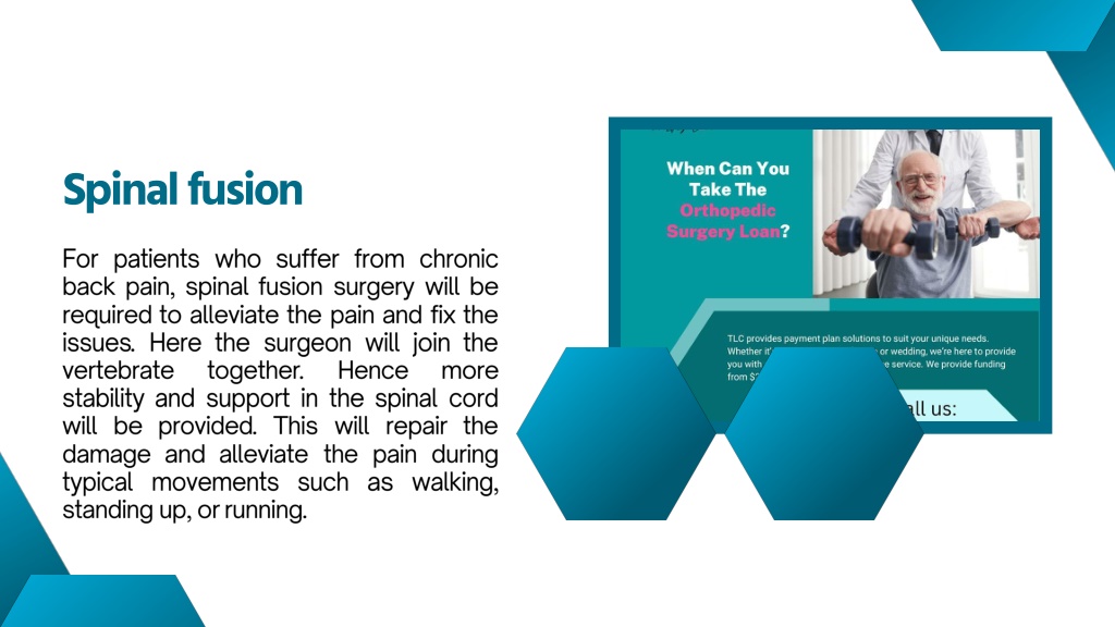 PPT - Orthopedic Surgery Loan - When Can We Take? PowerPoint ...