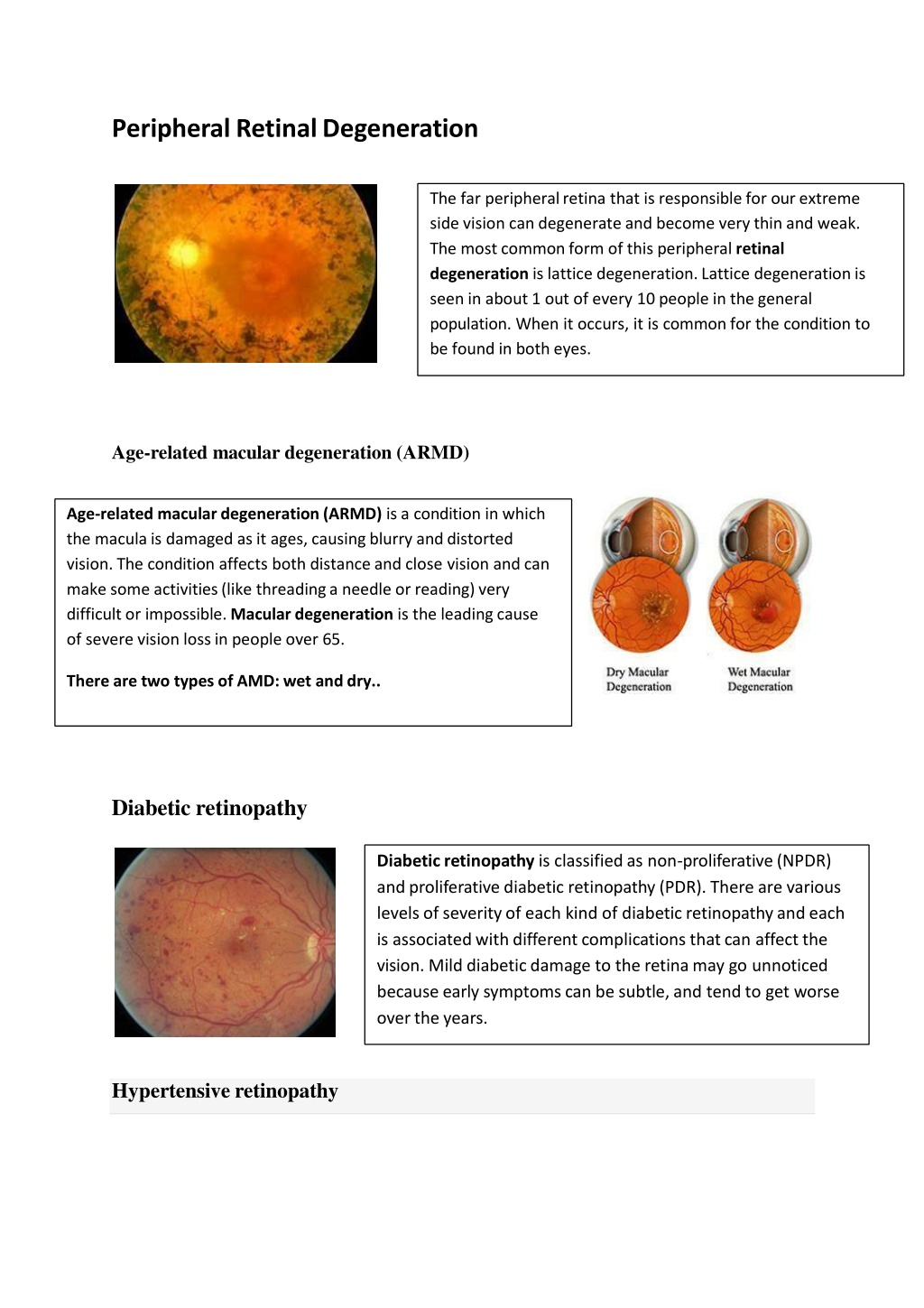 PPT - Retinal Disorders Treatment In Mumbai, India PowerPoint ...