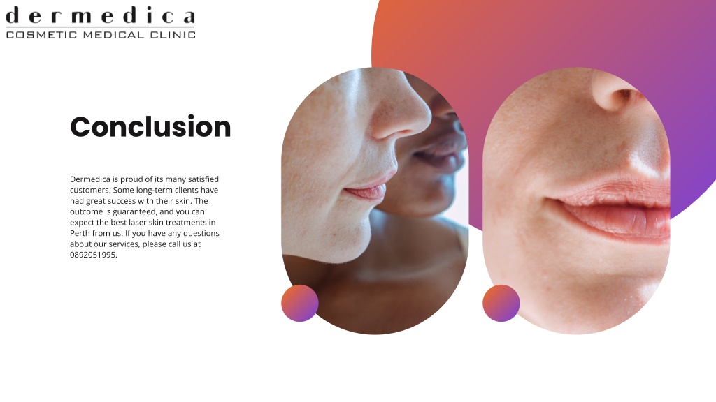 PPT - Laser Skin Treatment Perth PowerPoint Presentation, free download ...