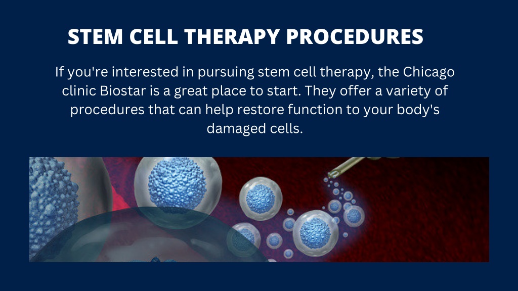 PPT - Stem Cell Therapy Clinic in Chicago PowerPoint Presentation, free ...
