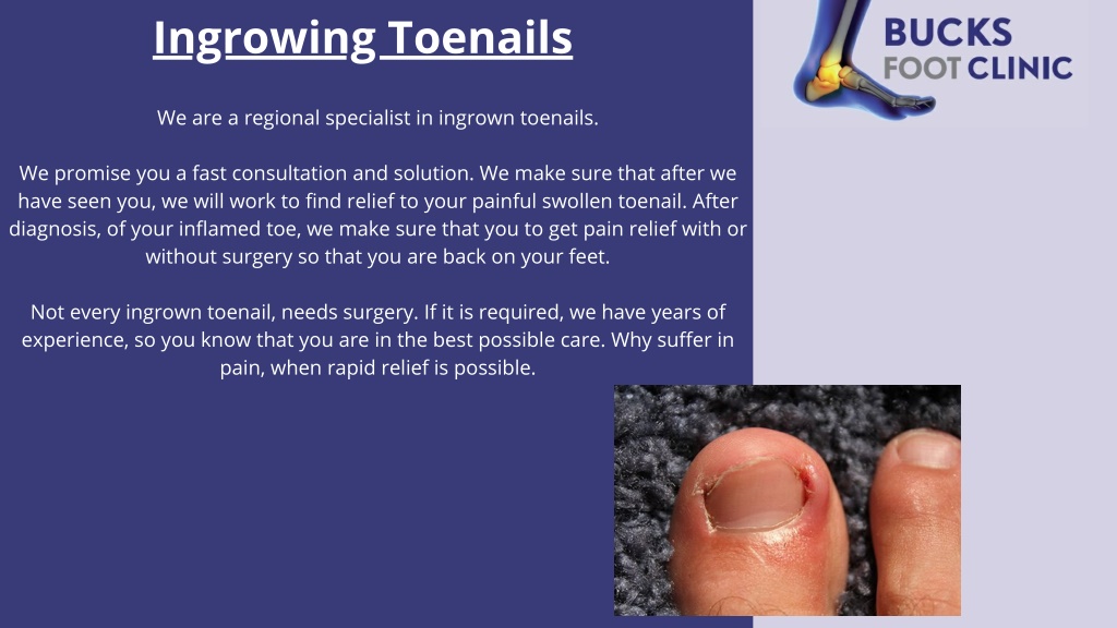 PPT - What you need to know about Ingrown Toenail Infections PowerPoint ...
