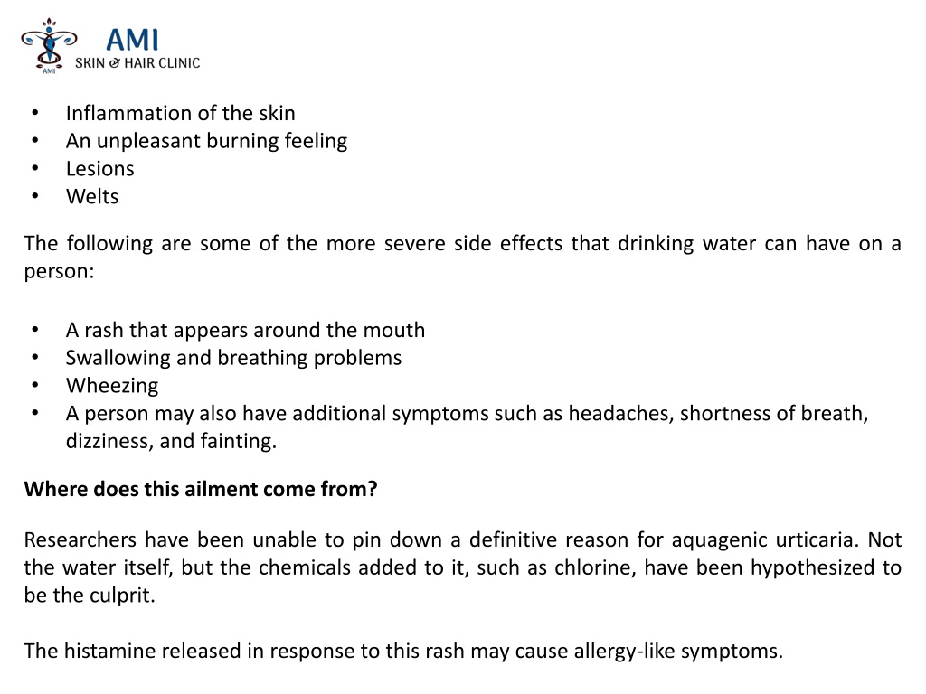 Ppt Aquagenic Urticaria Symptoms Causes Treatment Prevention And