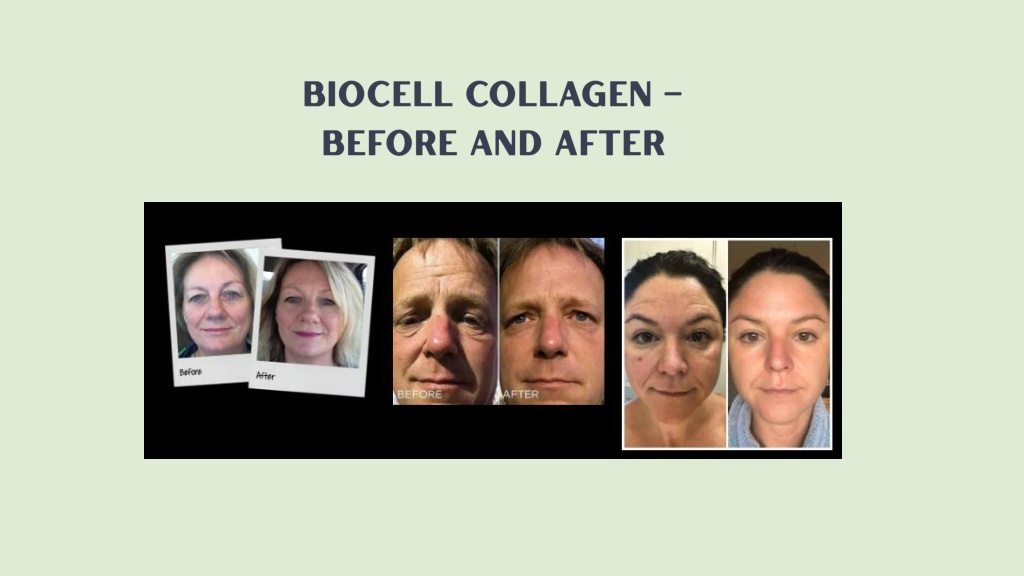 PPT - Biocell Collegen Benefits PowerPoint Presentation, free download ...