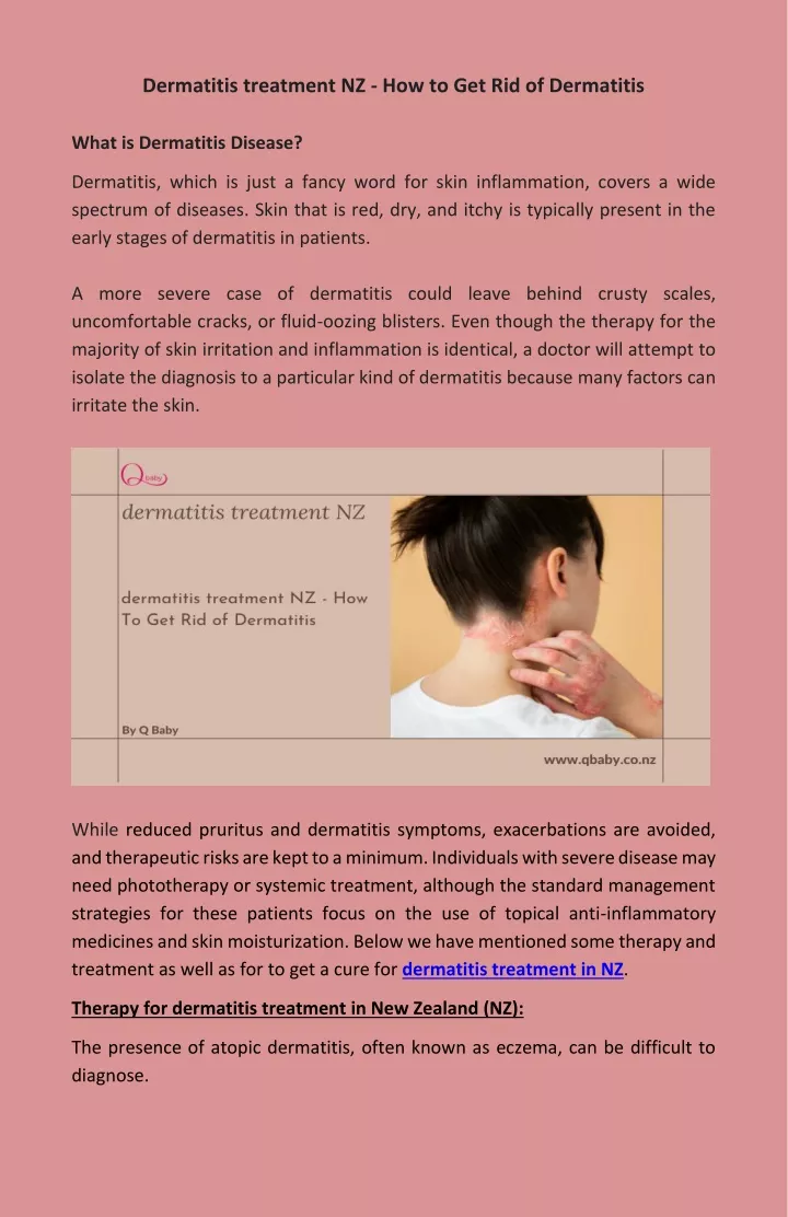 PPT - dermatitis treatment NZ - How To Get Rid of Dermatitis PowerPoint ...