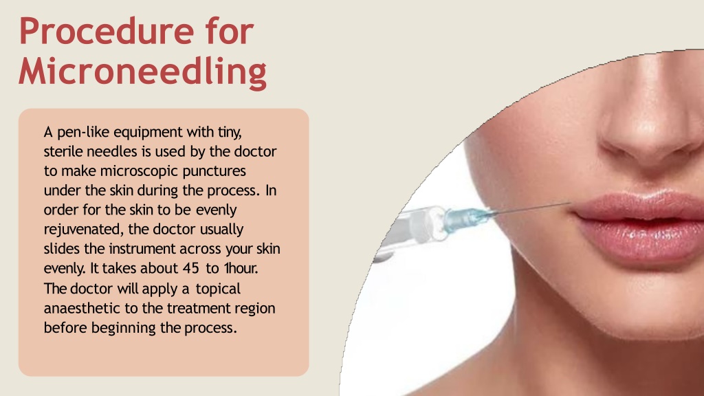 PPT - Microneedling Services in Watford - Aura Tan & Beauty PowerPoint ...