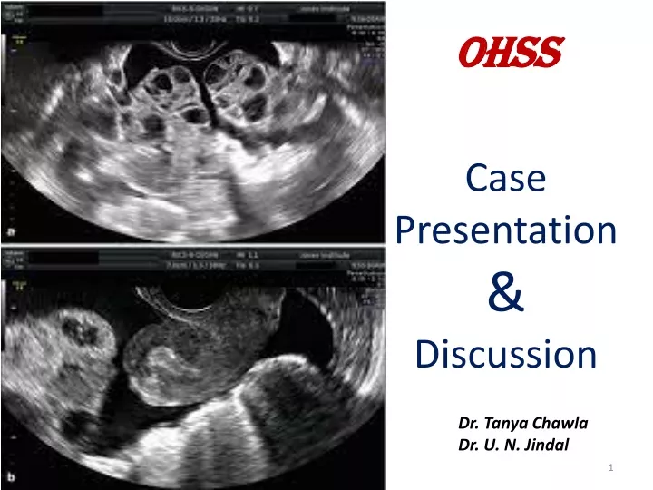 PPT - OHSS Case Presentation & Discussion | Jindal IVF Chandigarh ...