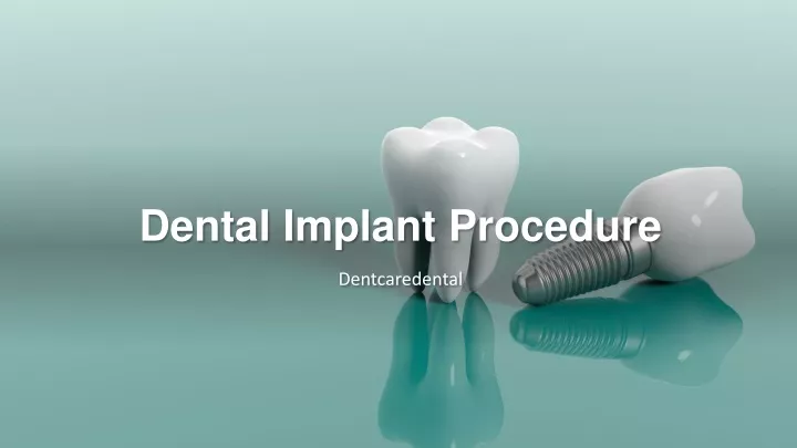 PPT - Dental Implant Procedure PowerPoint Presentation, free download ...