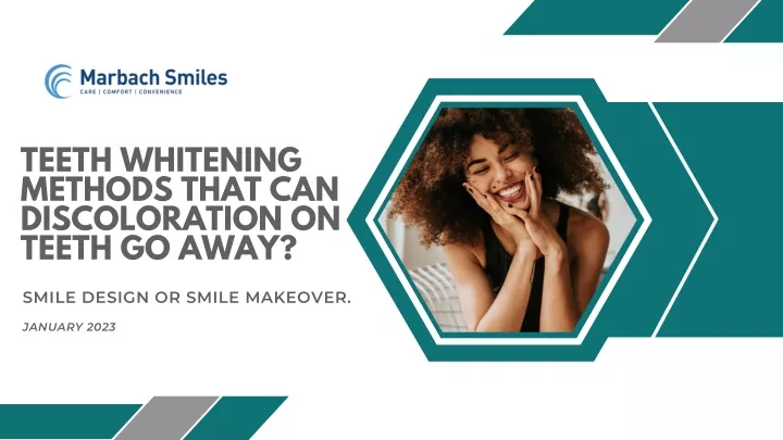 PPT - Teeth Whitening Methods That Can Discoloration On Teeth Go Away ...