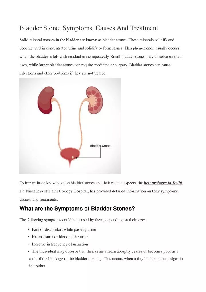 PPT - Bladder Stone: Symptoms, Causes And Treatment PowerPoint ...