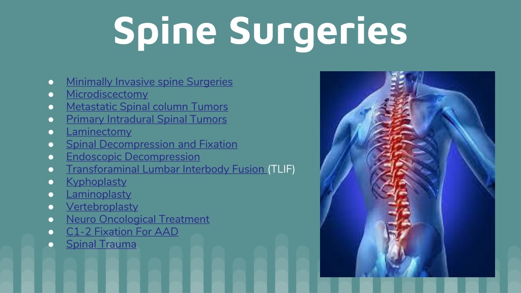 PPT - Best Neuro and Spine surgeon in Delhi PowerPoint Presentation ...