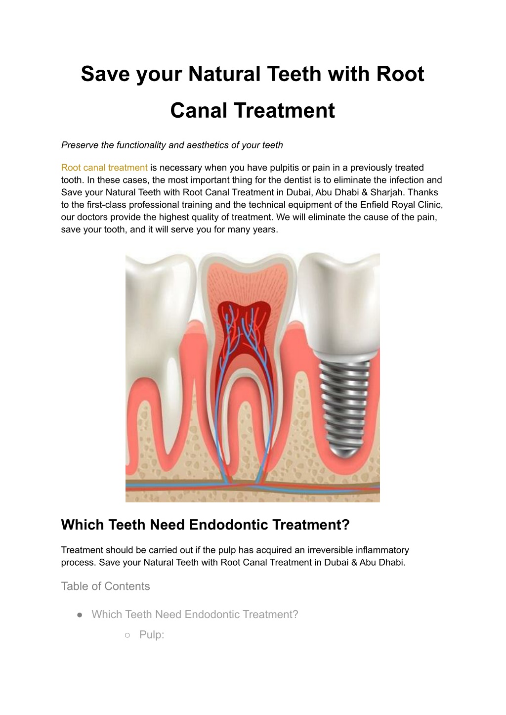 PPT - Save your Natural Teeth with Root Canal Treatment PowerPoint ...