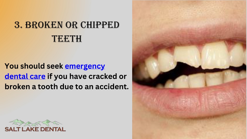 PPT - Signs You Need Emergency Dental Care PowerPoint Presentation ...