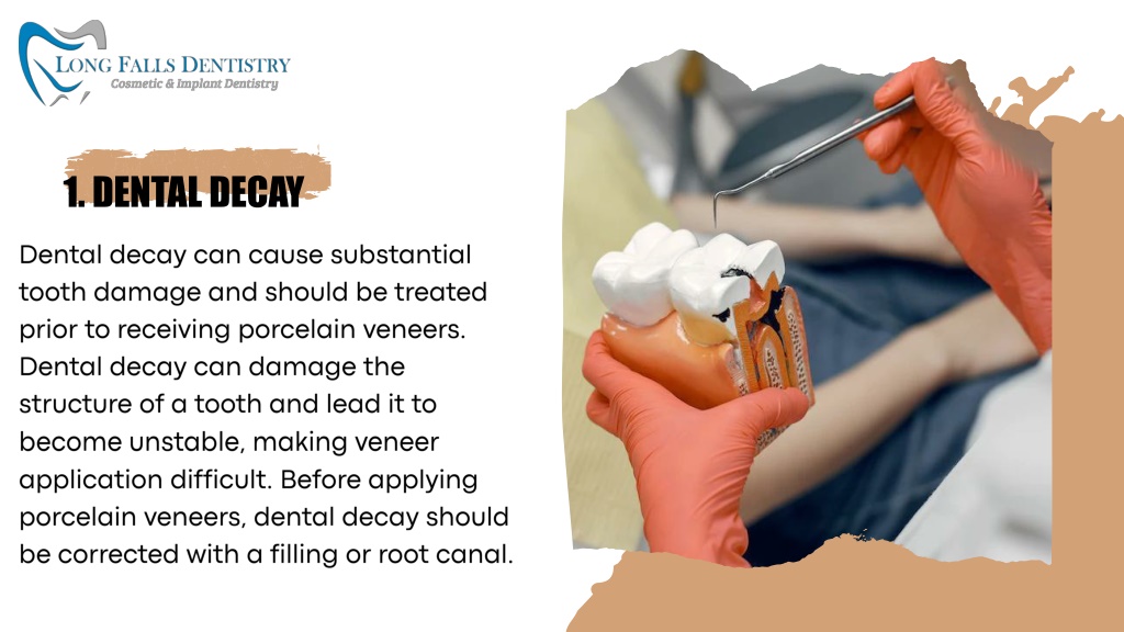 PPT - Signs You are a Good Candidate for Dental Veneers PowerPoint ...