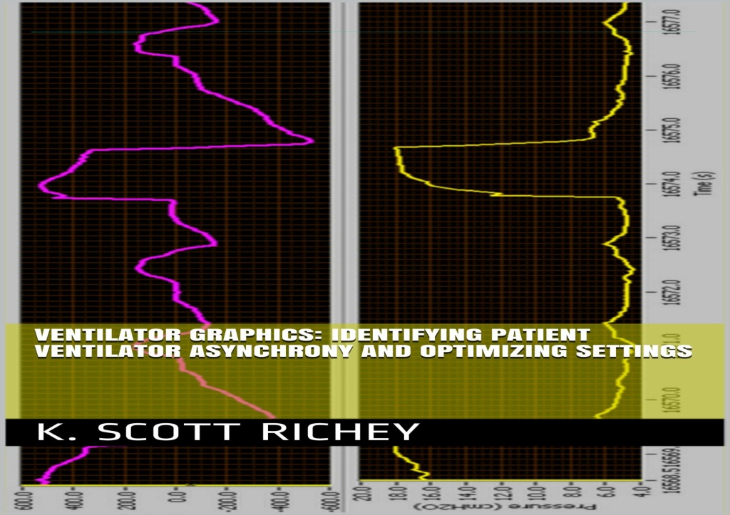 PPT - ‹download› book (pdf) Ventilator Graphics: Identifying Patient ...