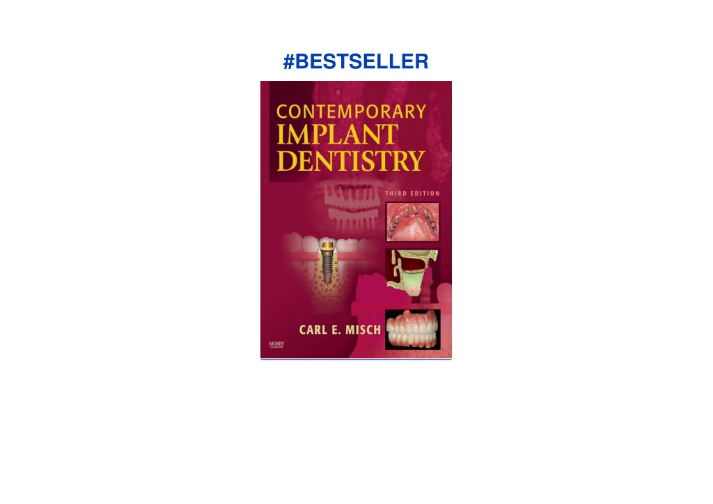 PPT - full ‹download› (pdf) Contemporary Implant Dentistry - E-Book PowerPoint Presentation - ID ...