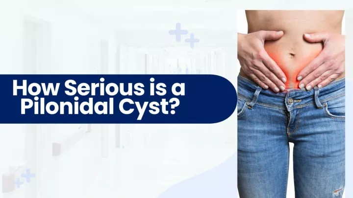 PPT - Find The Best Pilonidal Cyst Surgery Treatment in CA PowerPoint ...