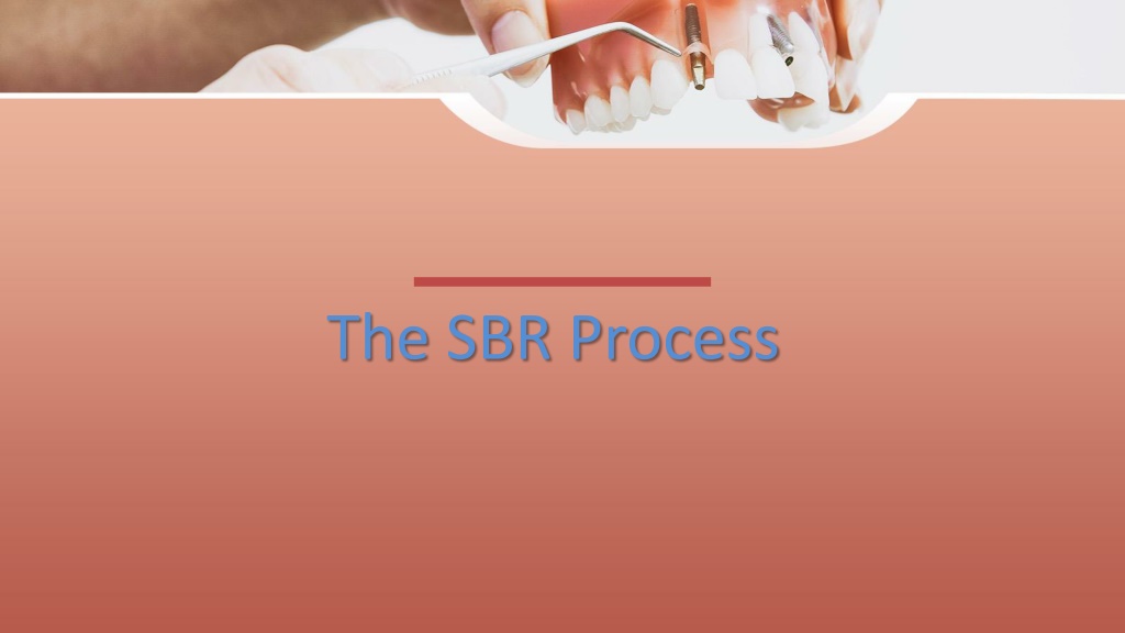 PPT - Wisdom Teeth Extraction Dentist Blue Ridge PowerPoint ...