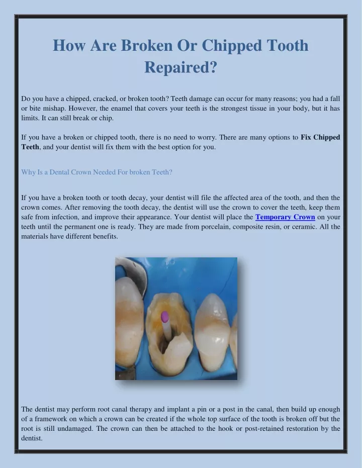 PPT - How Are Broken Or Chipped Tooth Repaired? PowerPoint Presentation ...