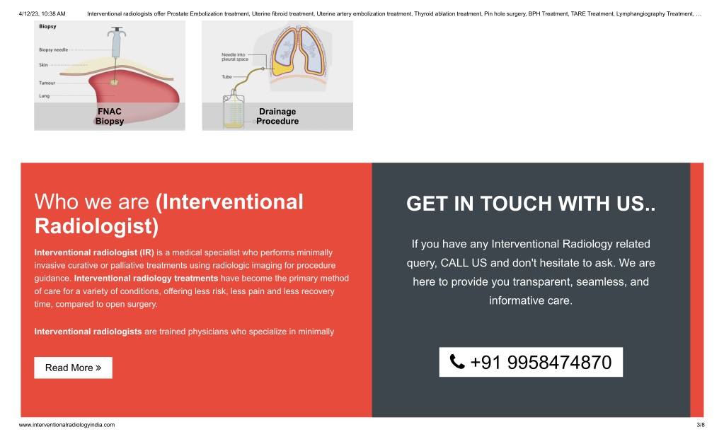 PPT - Pin hole surgery in Delhi PowerPoint Presentation, free download ...