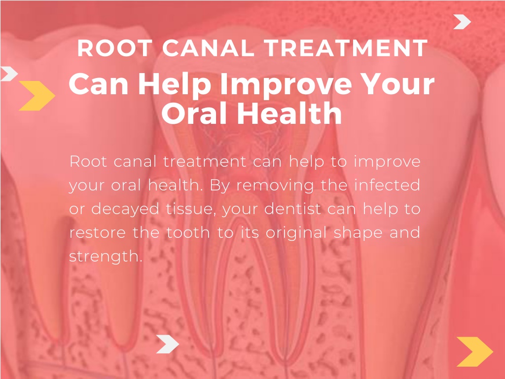 PPT - 10 Surprising Facts You Didn't Know About Root Canal Treatment ...