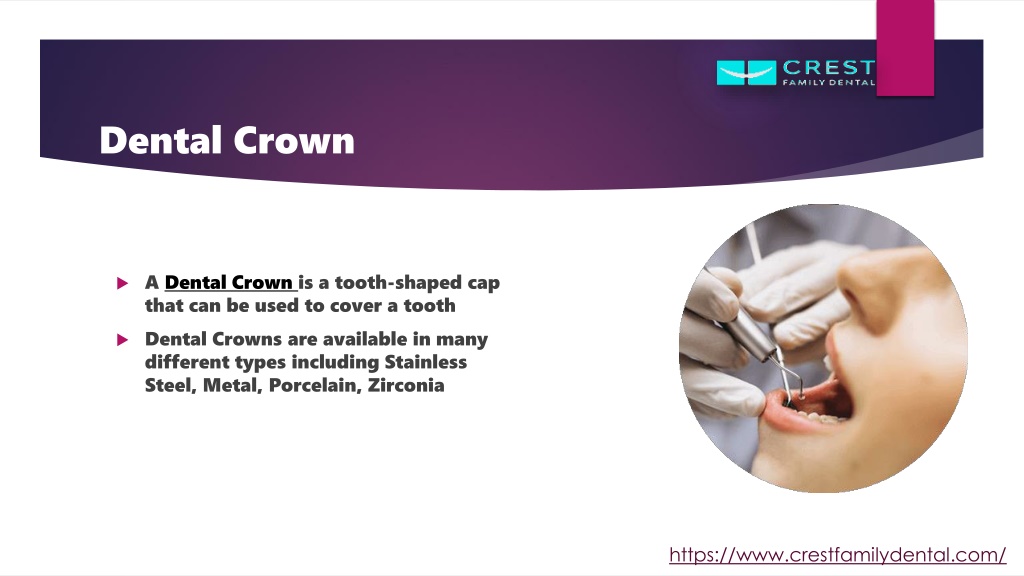 PPT - Crest Family Dental Clinic in Hartford, CT. for Implant Dentures ...