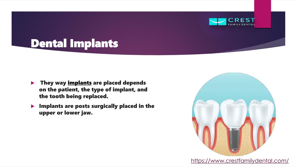 PPT - Crest Family Dental Clinic in Hartford, CT. for Implant Dentures ...
